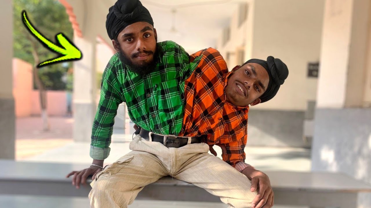 10 Truly Unusual Twins You Have Never Seen Before - YouTube