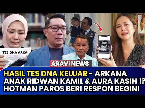 Hasil Tes DNA Keluar !! Bukti Arkana Anak Ridwan Kamil dan Aura Kasih ? Hotman Paris Ungkap Ini 