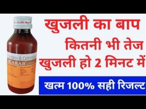 दाद,खाज,खुजली,और जुओं को खत्म करने की सबसे कारगर दवाई|| scablab lotion ...