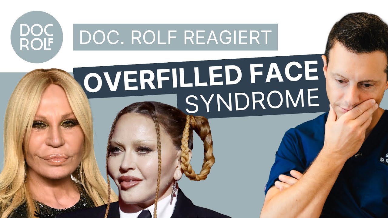 Das OVERFILLED FACE SYNDROME erklärt – Dr. Rolf Bartsch - YouTube