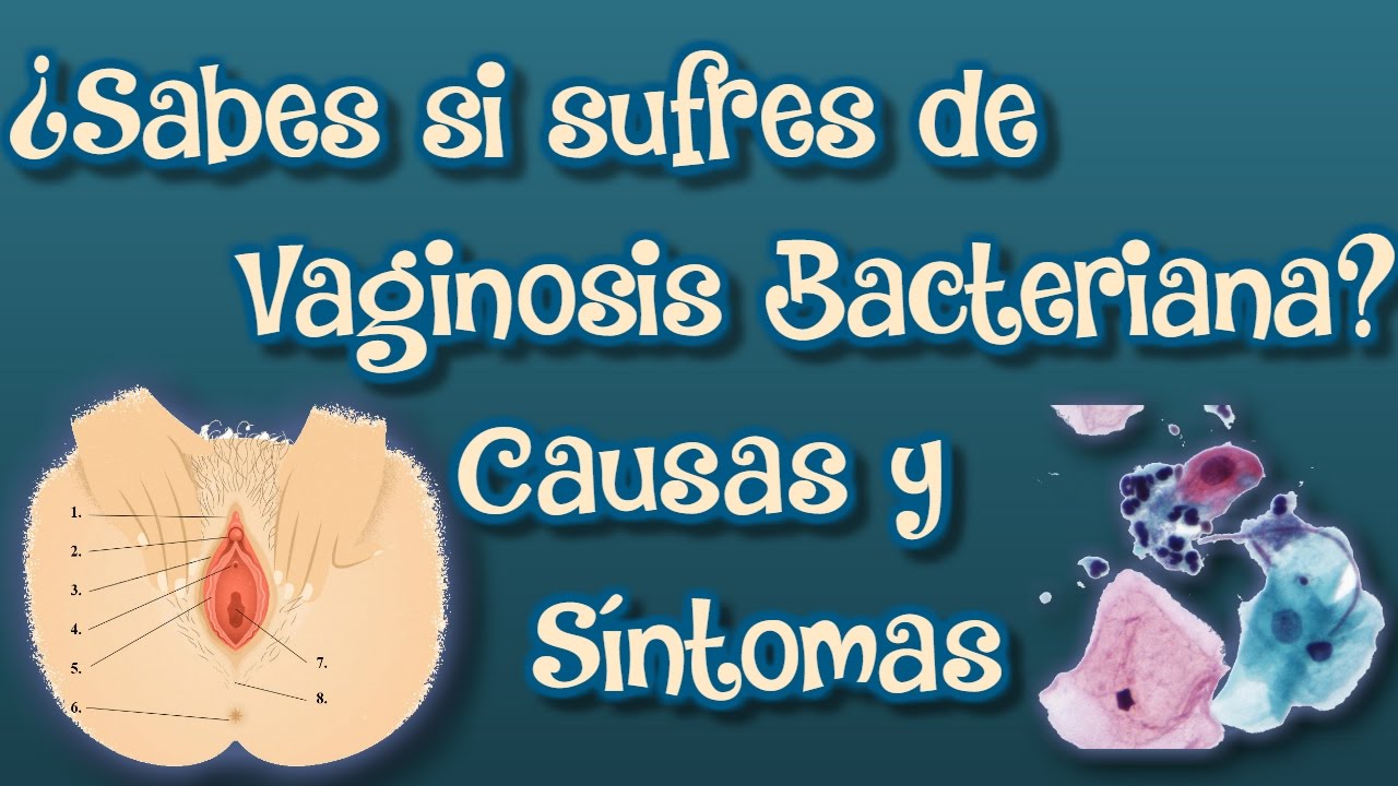 Cómo EVITAR la VAGINOSIS BACTERIANA? / CAUSAS y SINTOMAS de la ...