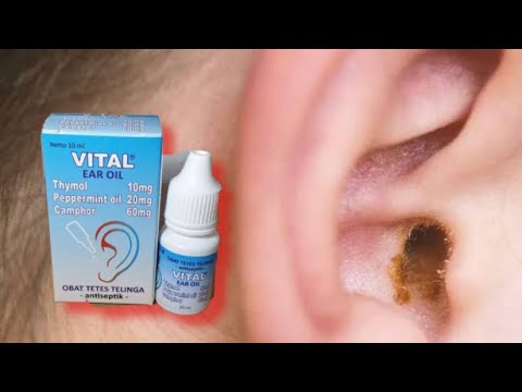 Informasi Obat tetes telinga Vital Ear Oil untuk mengatasi kotoran ...