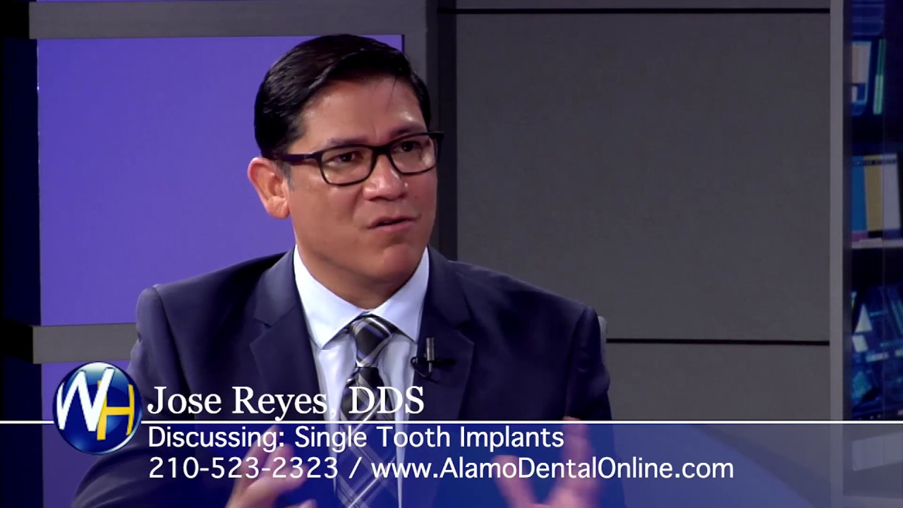 Single Tooth Implants with San Antonio, TX dentist Dr. Jose Reyes - YouTube