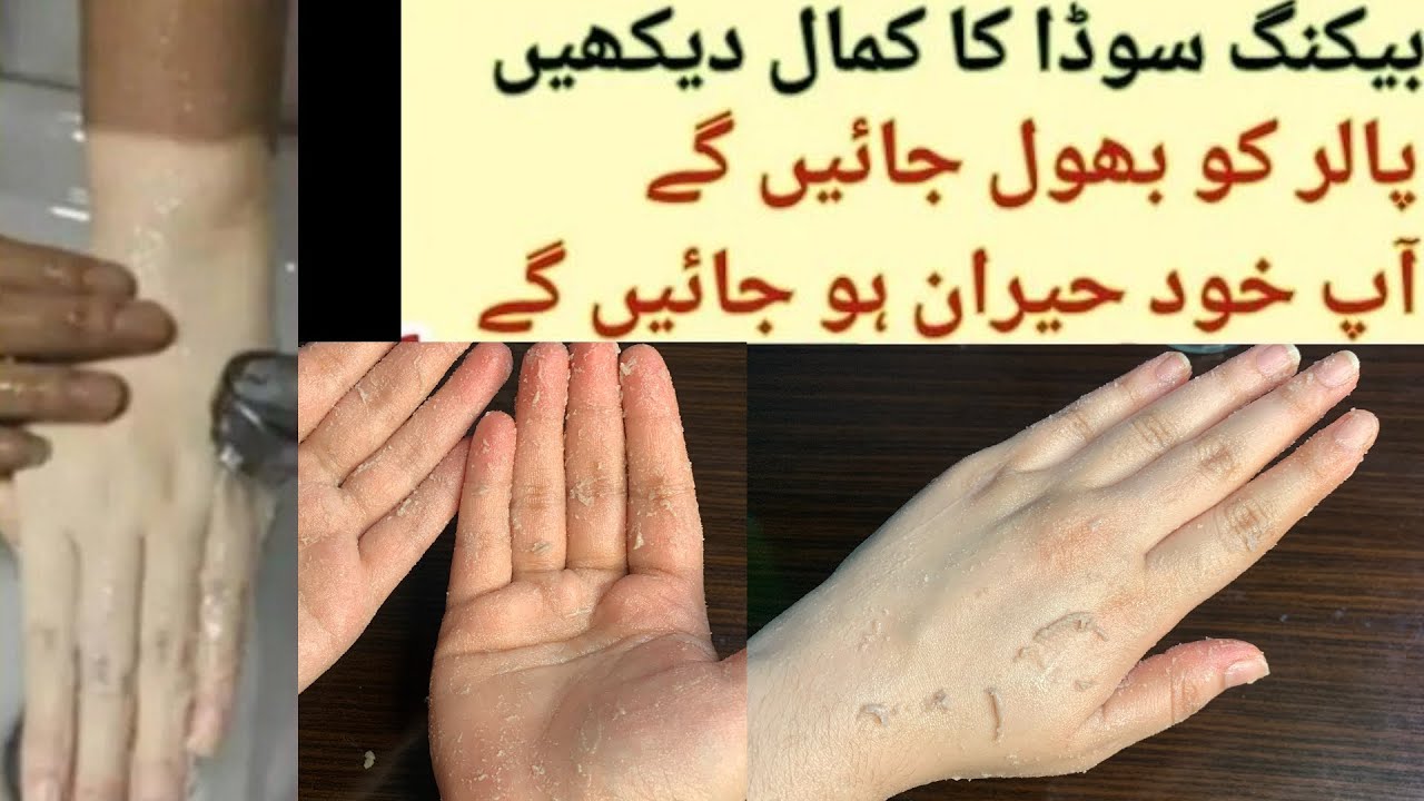 Best Hands Feet Whitening Cream at Home | Skin Lightning Remedy ...