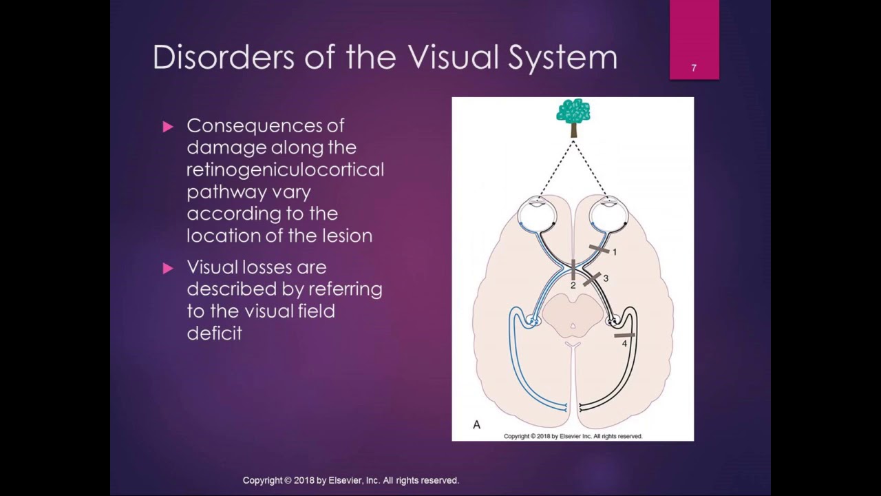 Chapter 21 Lecture Part 1 Visual System and Visual Disorders - YouTube