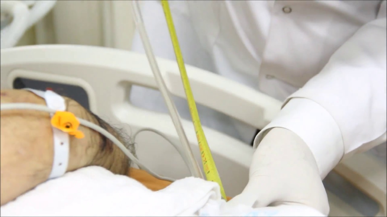 İntra abdominal Basınc Ölçümü (Klasik) - YouTube