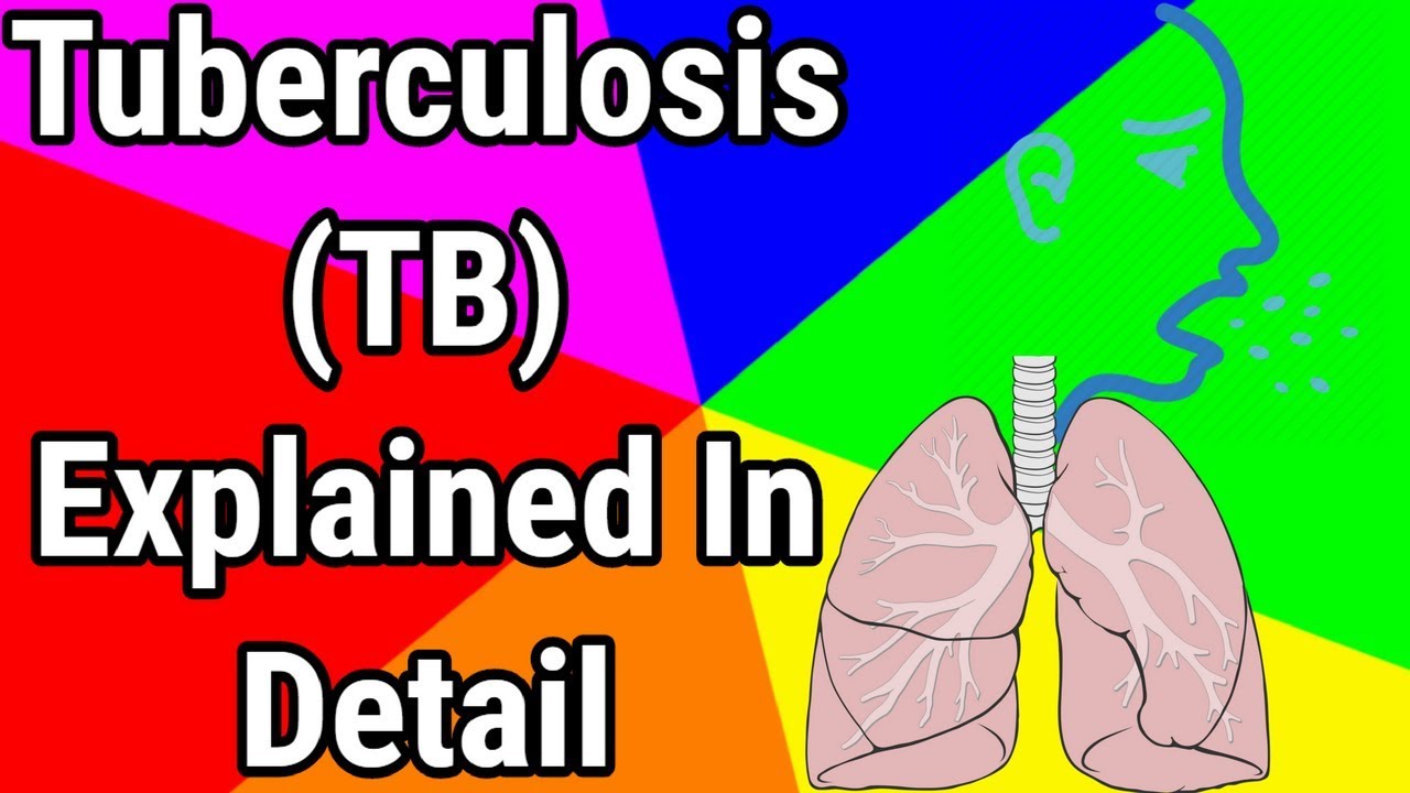 Tuberculosis (TB) explained- How it is caused? - YouTube