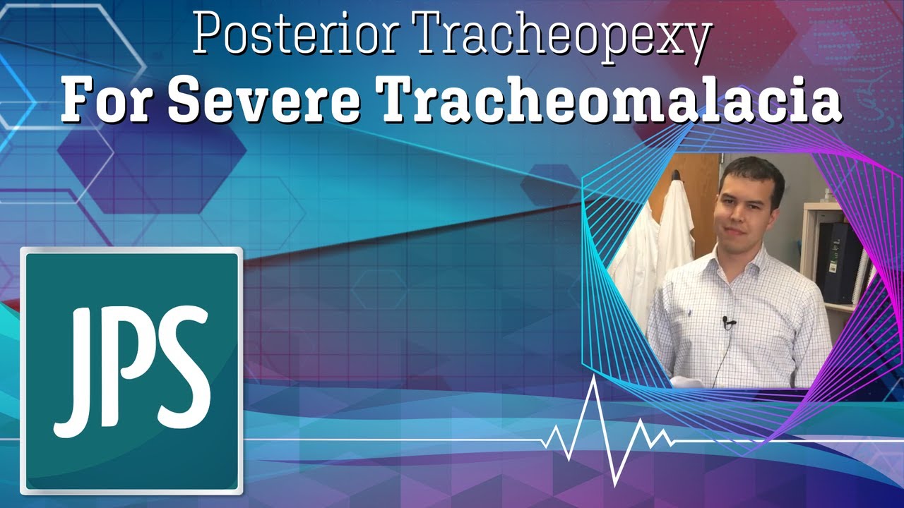 Posterior Tracheopexy For Severe Tracheomalacia - YouTube