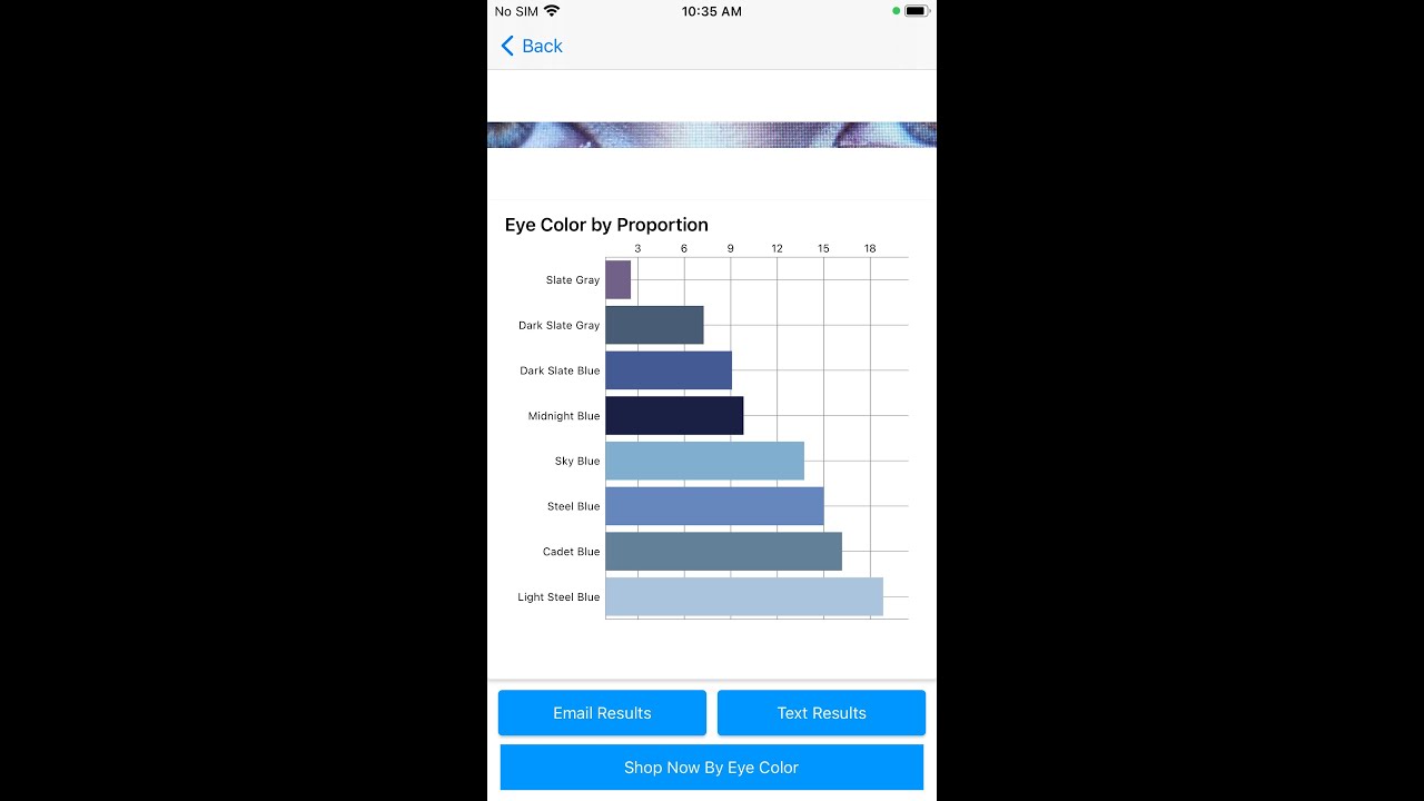 Track Newborn Baby's Eye Color Progression - YouTube