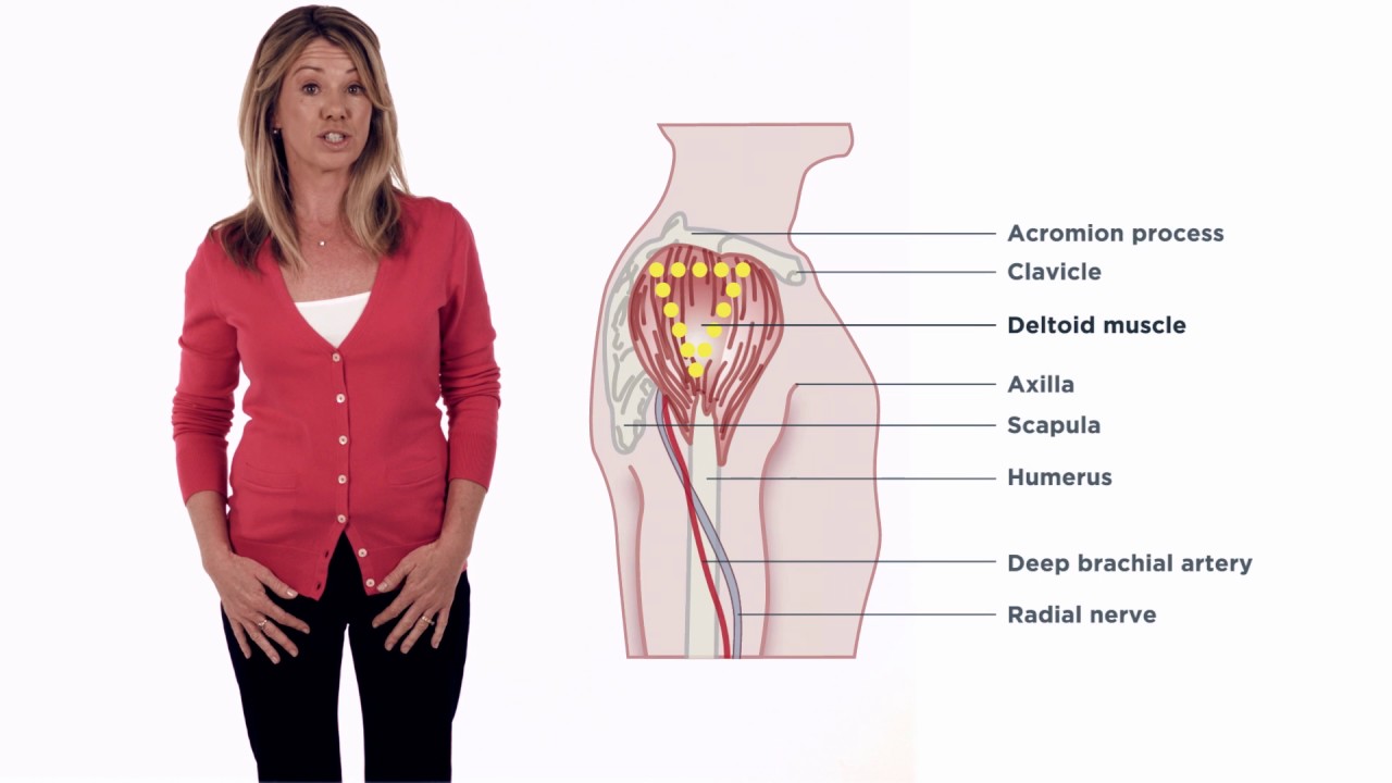 Invega Sustenna - How to Video - YouTube