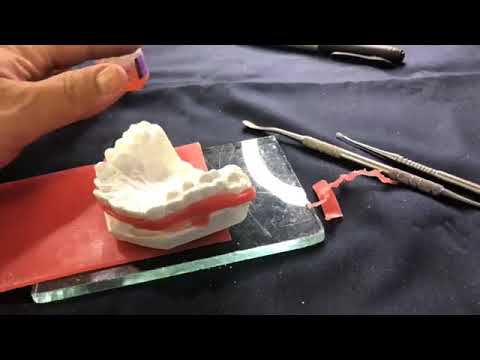 Guarda oclusal de acrílico - YouTube