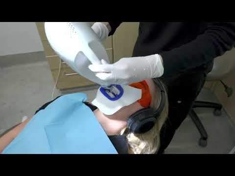 Teeth Whitening in Bondi | Bondi Family Dentist