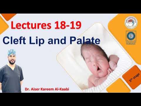 Cleft lip and Palate Lec. 18,19 Part 1 - YouTube