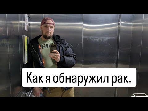 Рак кишечника. Как выявили диагноз. #онкология #рак #раккишечника # ...