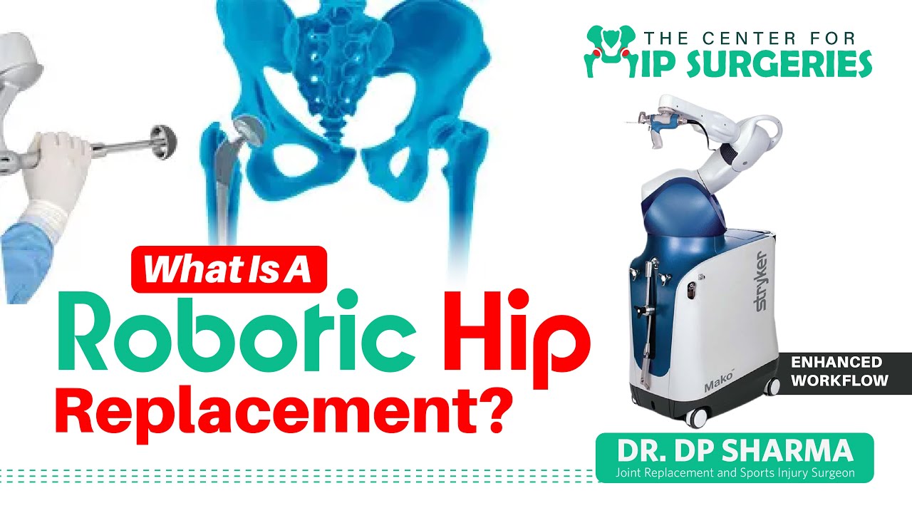 What Is A Robotic Hip Replacement Surgery? Robotic Hip Surgeon In Delhi ...