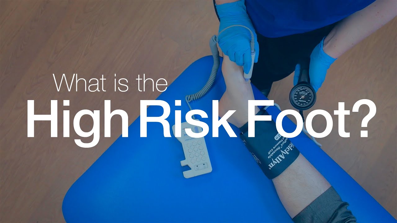 What is High Risk Foot? - YouTube