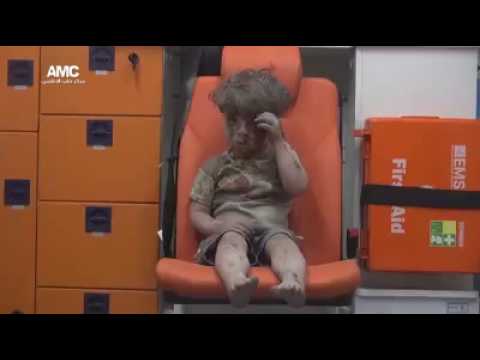 Halep Bombalanması Sonrası Ümran Bebek