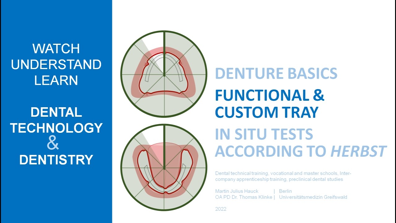 360 ° | in situ check of functional and individual trays according to ...