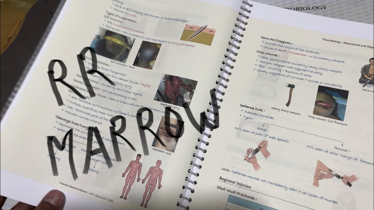 Opening Marrow Ed 8 Rapid revision notes till 3 rd mbbs and ortho ...