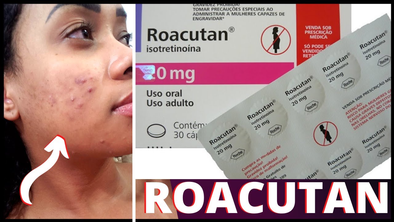 COISAS QUE DEVEMOS SABER E FAZER DURANTE O ROACUTAN - YouTube