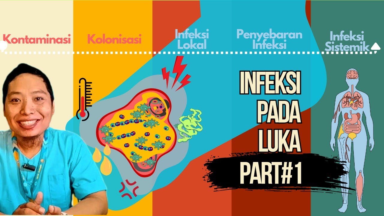 Perbedaan Luka Kontaminasi, Luka Kolonisasi dan Luka Infeksi # ...