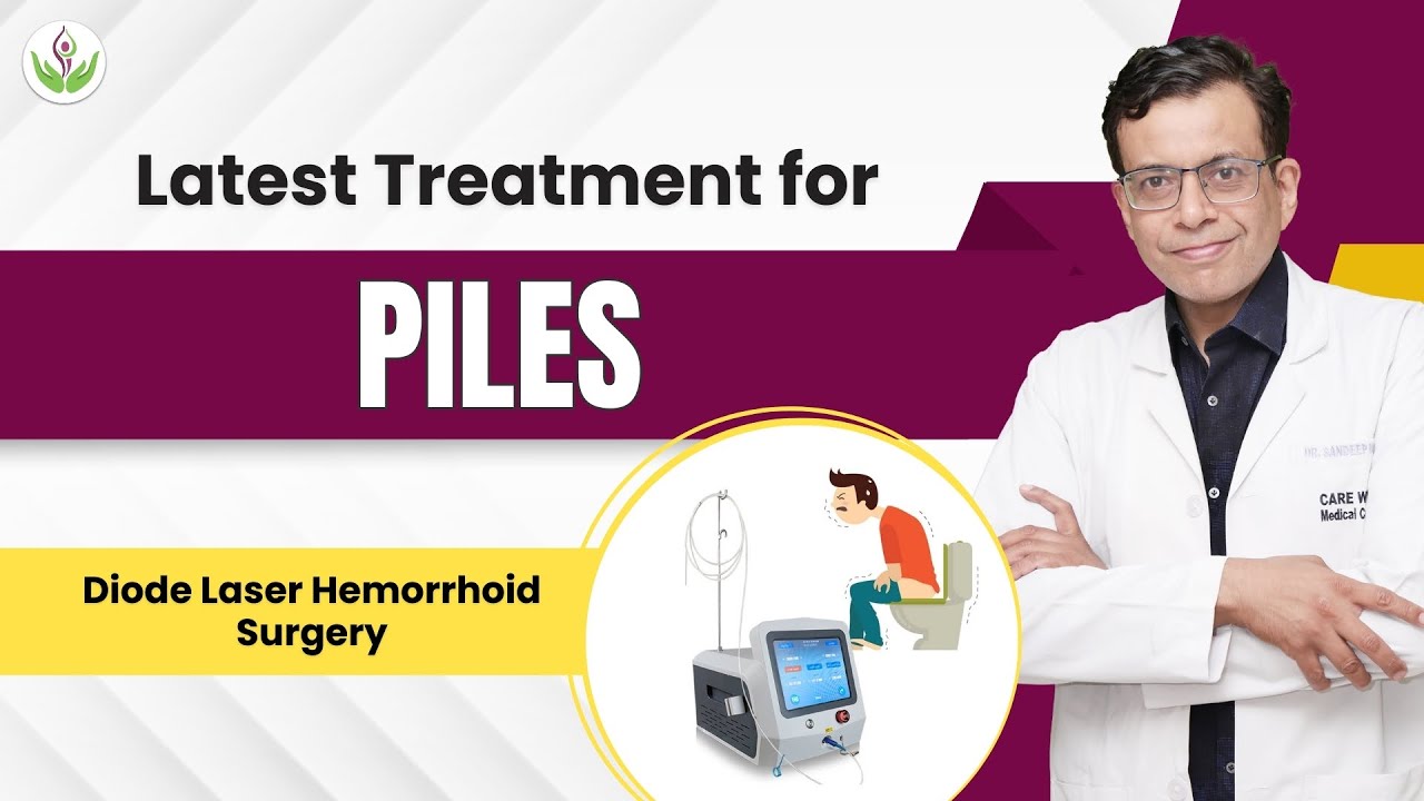 Latest Treatment for Piles: Diode Laser Hemorrhoid Surgery | Care Well ...