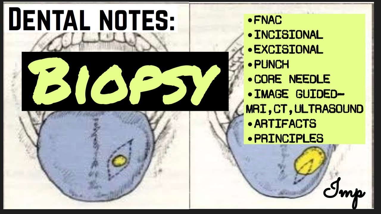 BIOPSY II METHODS IN DEPTH II ORAL PATHOLOGY AND ORAL SURGERY II PART 2
