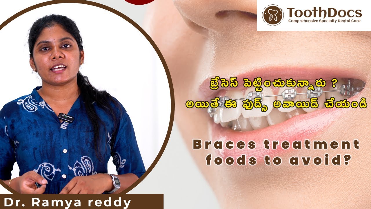 బ్రేసెస్ పెట్టించుకున్నారు ? అయితే ఈ ఫుడ్స్ అవాయిడ్ చేయండి | Dr.Ramya ...