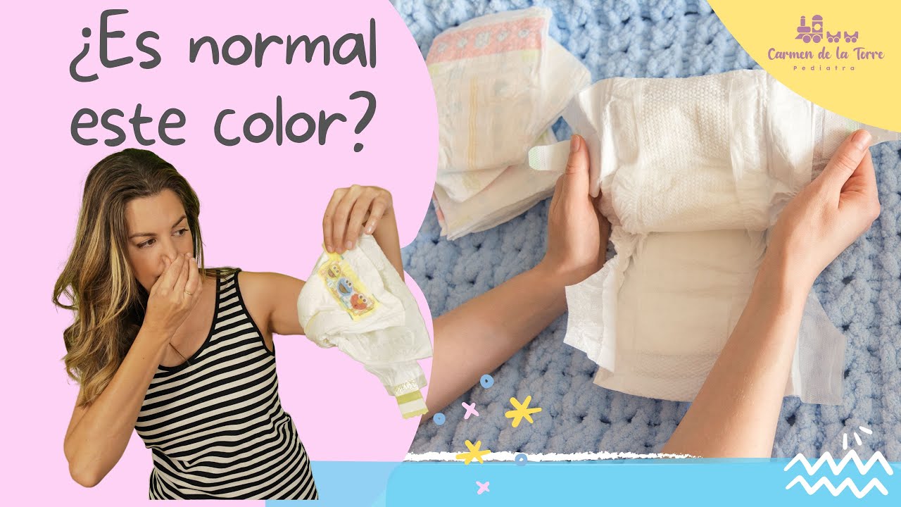DOCTORA ¿ESTE COLOR DE CACAS ES NORMAL? - YouTube