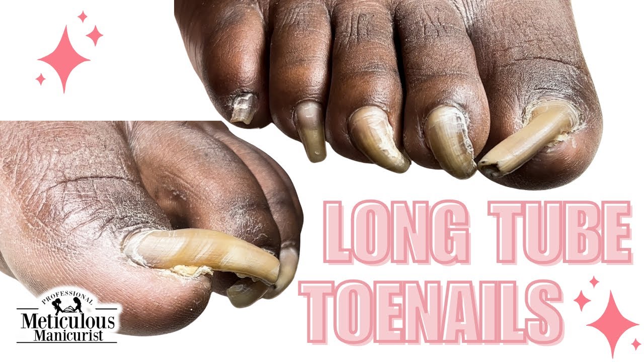 Trim Long Toenails Tutorial #nails #satisfying - YouTube