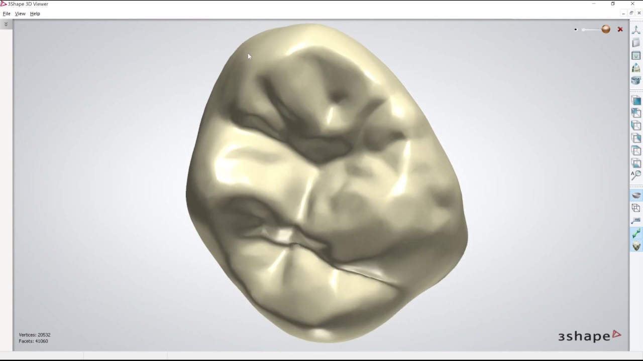 3shape STL export (use UDX file) - YouTube