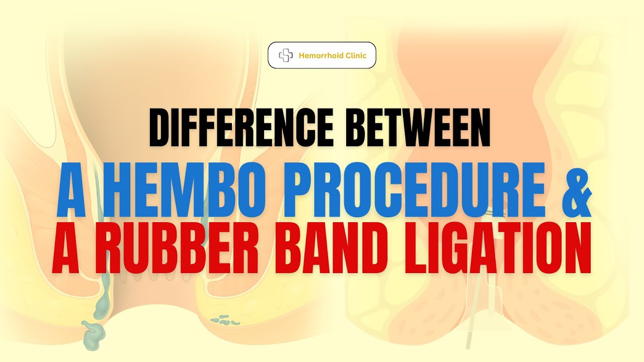 Difference Between A Hembo Procedure & A Rubber Band Ligation - YouTube
