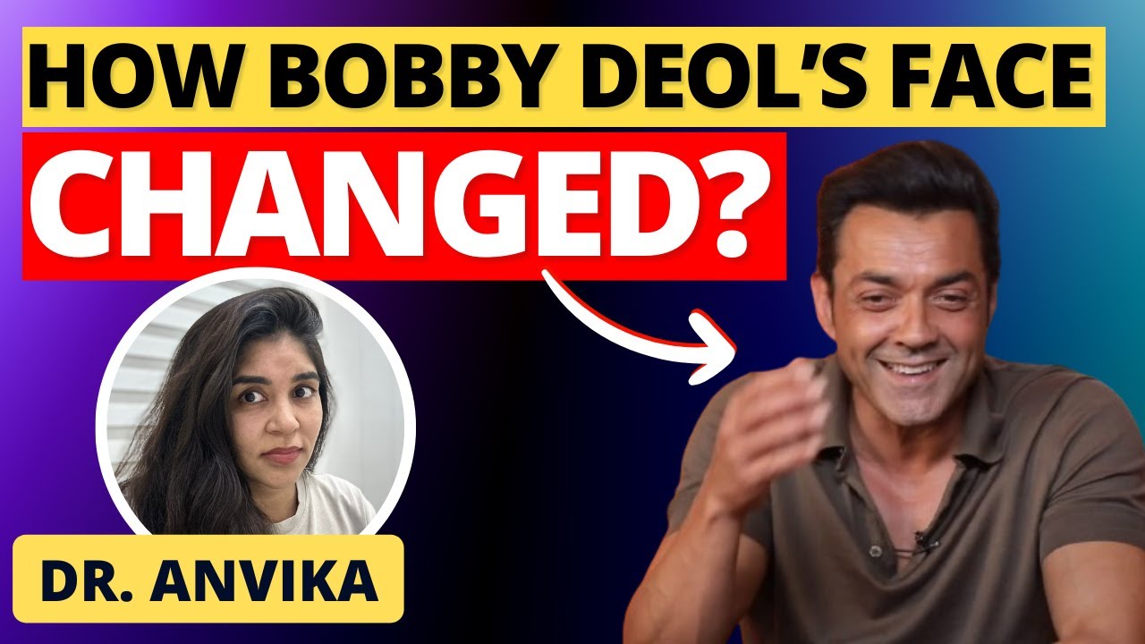 Bobby Deol's Face Review || How Bobby Deol's Face Was Changed Day by ...