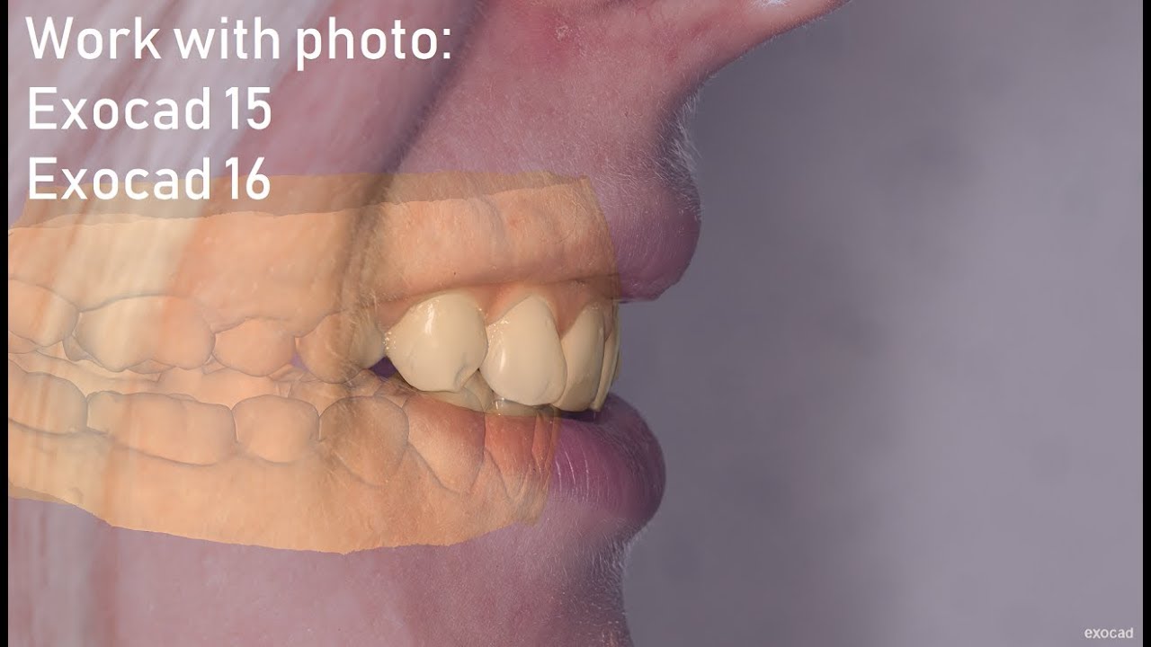 Photo import Exocad(15,16 versions)/ Импорт фото в версии 15 и 16 - YouTube