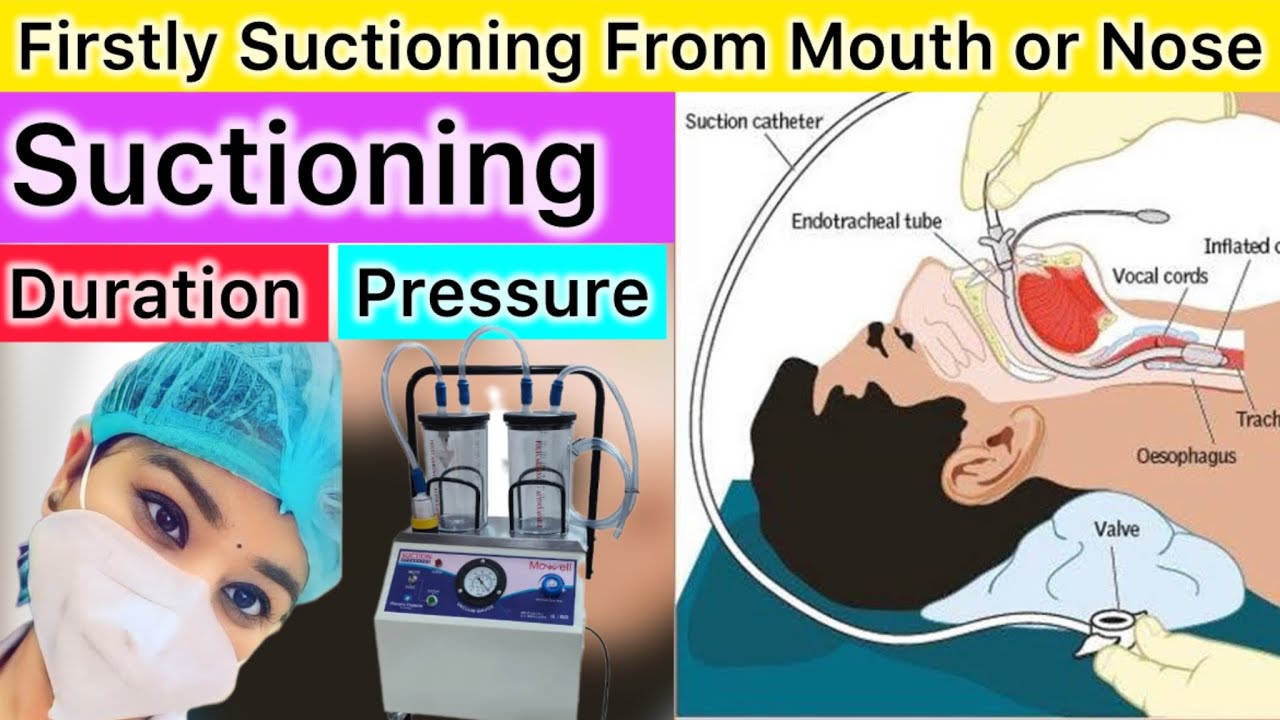 Suctioning - Duration & Pressure || Suction || Suction Pressure ...