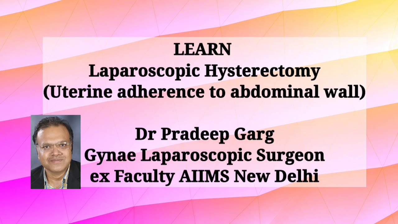 All About Lap Hysterectomy (TLH) By Dr Pradeep Garg, Gynae Laparoscopic ...