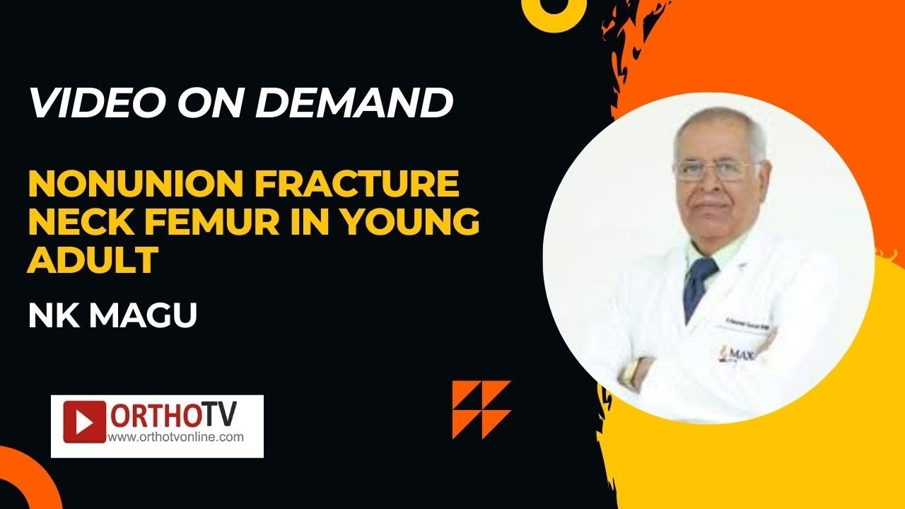 NONUNION FRACTURE NECK FEMUR IN YOUNG ADULT - NK MAGU - YouTube