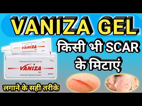 VANIZA GEL USE || VANIZA GEL USE IN HINDI || किसी भी दाग को मिटाए 8 दिन ...