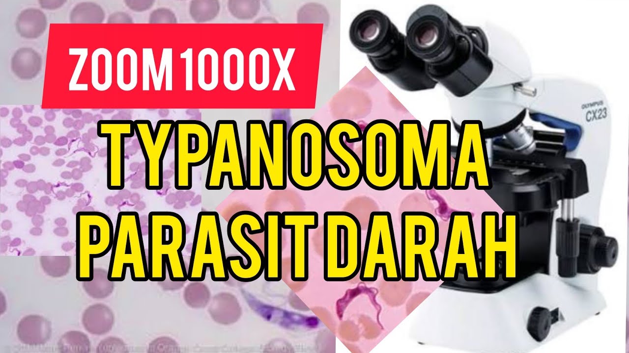 ZOOM 1000X : Trypanosoma Parasit Darah Pada Sapi - YouTube