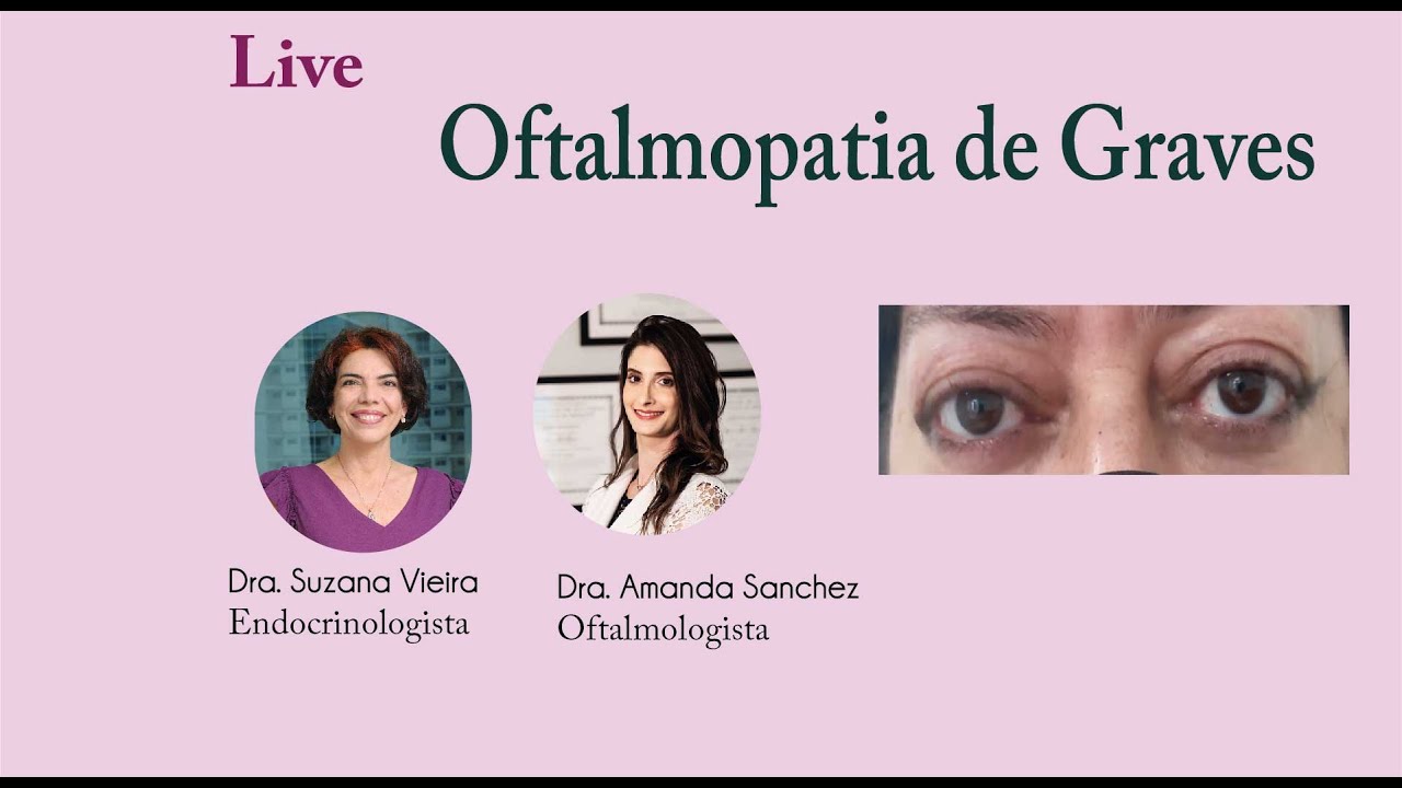 Live sobre orbitopatia (ou oftalmopatia) de Graves - YouTube