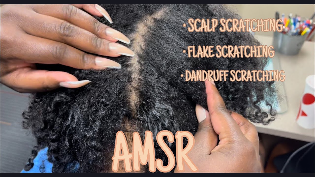 ASMR | DANDRUFF SCRATCHING ~ FLAKES ~ SCALP MASSAGE | REAL PERSON - YouTube
