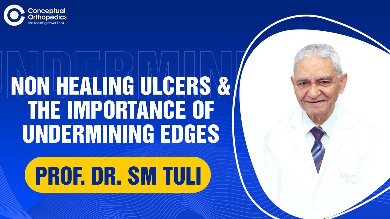 Non healing ulcers and the importance of undermining edges by Prof. Dr ...