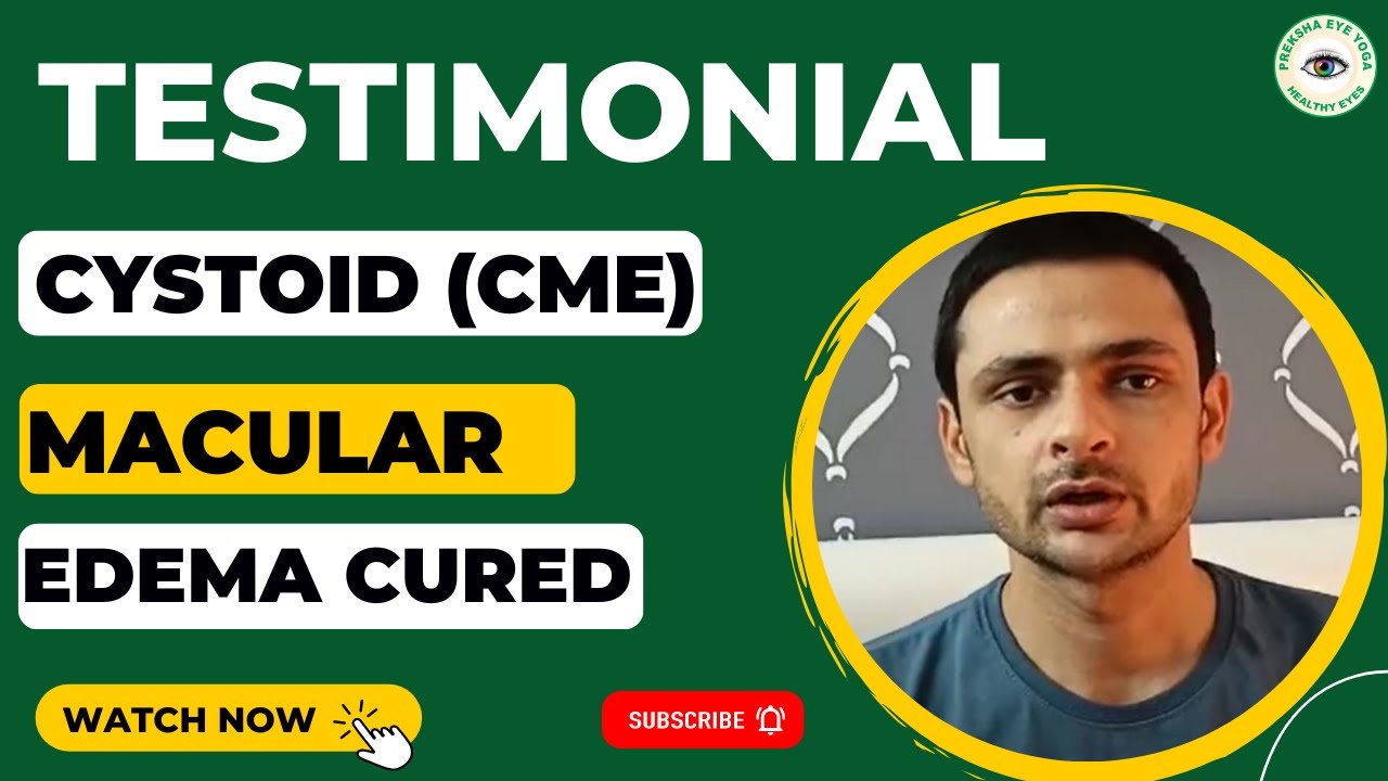 CYSTOID MACULAR EDEMA CURED NATURALLY EYE YOGA edema cystoid-macular-edema-cured-naturally-eye-yoga-edema