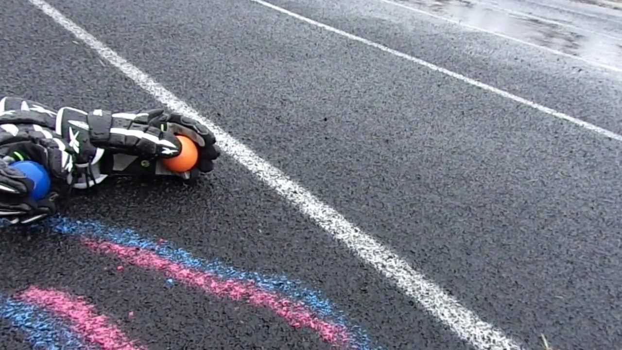 "Pathophysiology", Giant Cell (Temporal) Arteritis and Polymyalgia ...