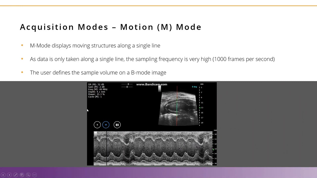 How high frequency ultrasound imaging is supporting preclinical ...