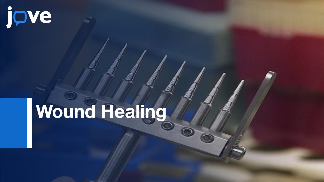 Cell Migration/Wound Healing in a 96-Well Plate | Protocol Preview ...