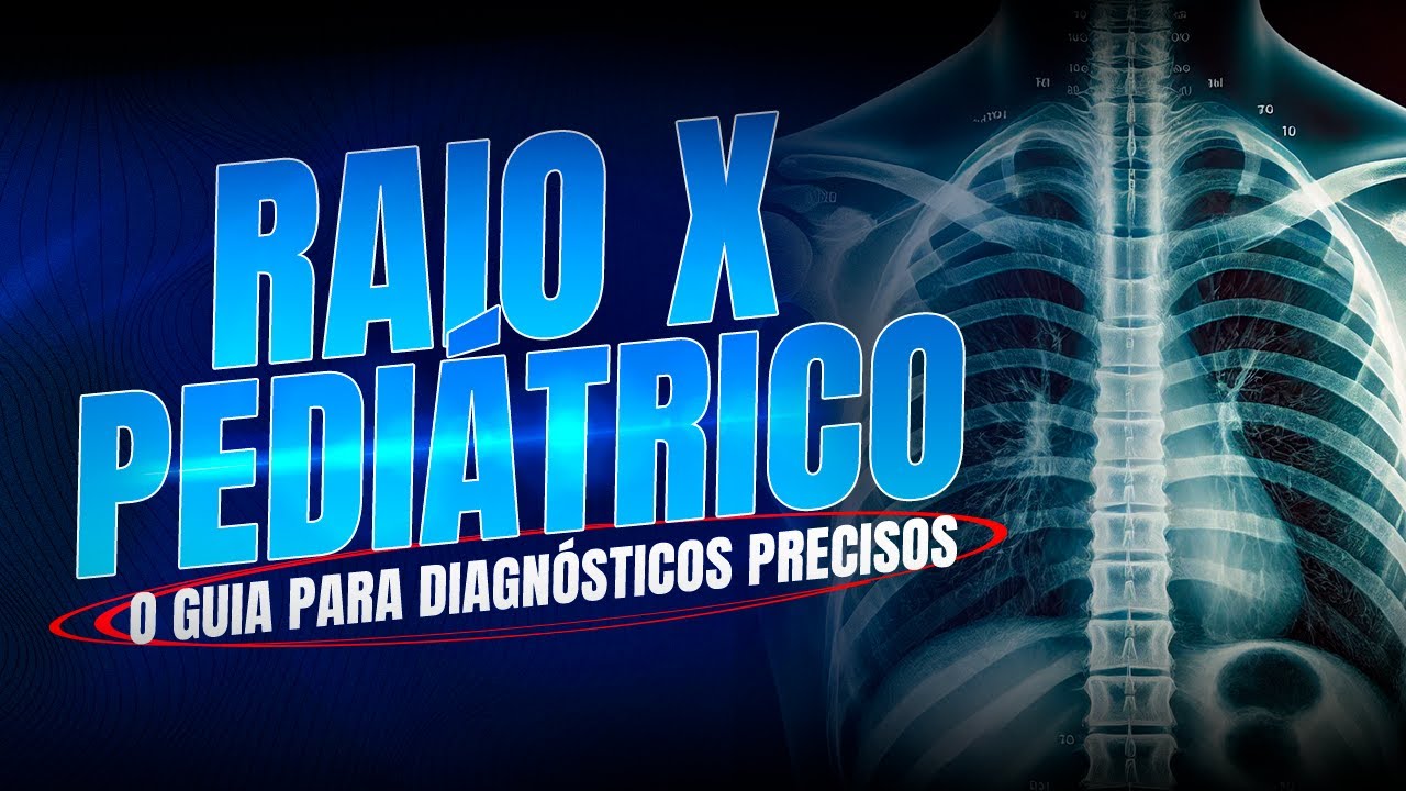 Raio X pediátrico - o guia para diagnósticos precisos - Dr. Caíque ...