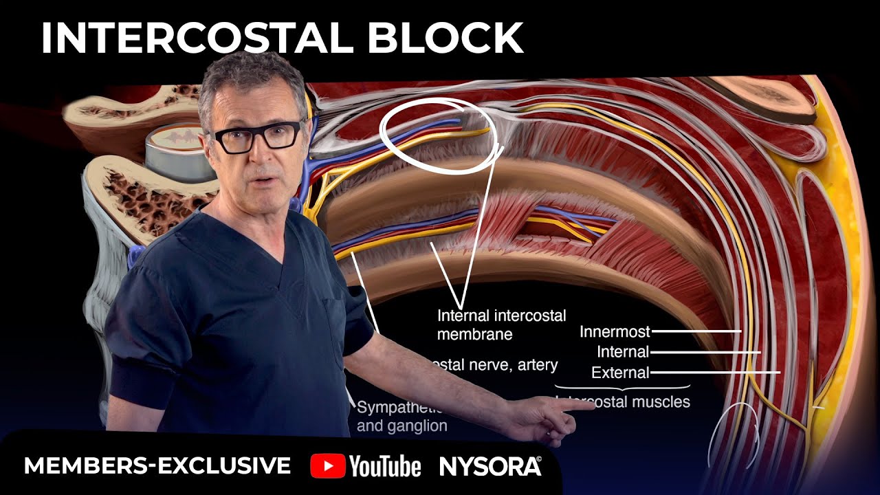 Intercostal nerve block: The Ultimate Analgesia for Chest Wall - YouTube