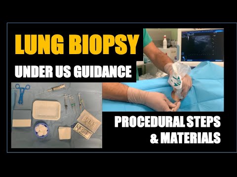 US-guided Lung Biopsy: procedural steps and material - YouTube