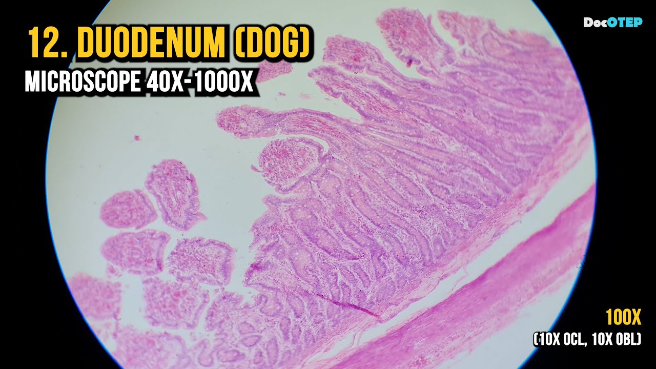 Duodenum Slide